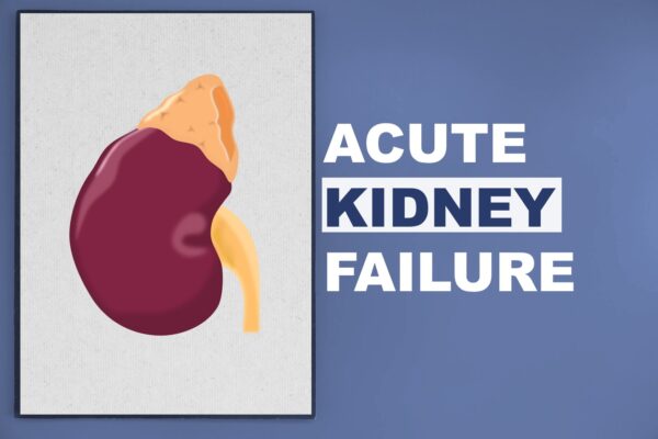 Acute Kidney (Renal) Failure | Causes, Symptoms & Treatments | Phoenix ...